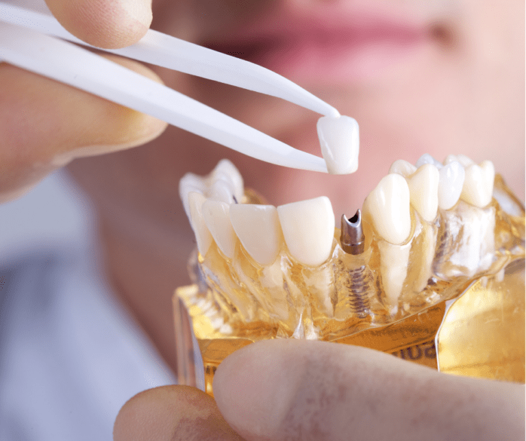 Advanced Composites in Medical Applications